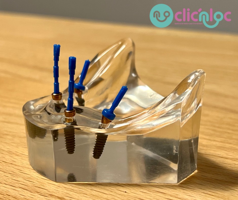 Adaptador angulado para implantes CLIC'N LOC | Sodimed